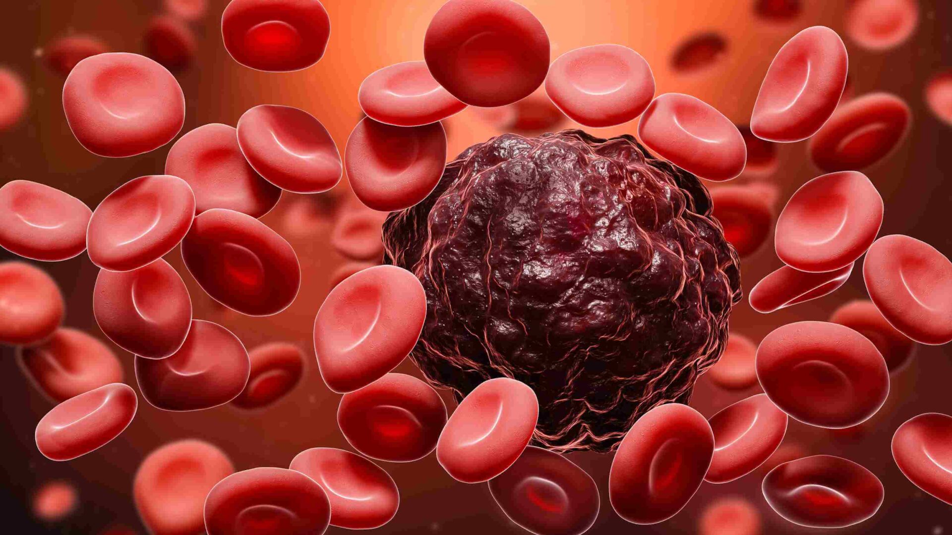 Understanding Blood Cancer: Types, Causes, And Treatment - Taazakhabar News
